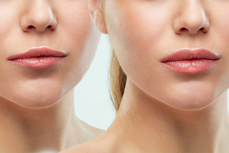 Facial Surgery | Baton Rouge, LA | Oral Surgeons